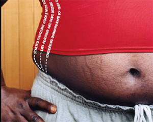 Obesity: An underestimated ‘silent killer’ - Vanguard News