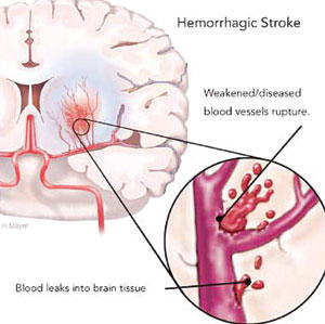 Treat head injuries with or without swelling, experts advise - Vanguard ...