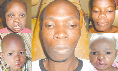 Health Mission provides succour for 11 indigent patients - Vanguard News