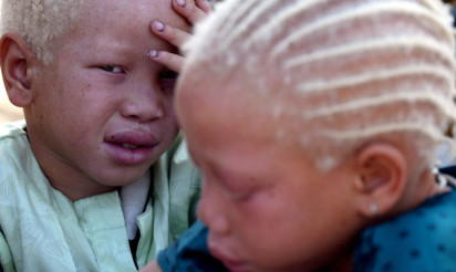 Killing spree of albinos fuelled by ritual practices and policing ...