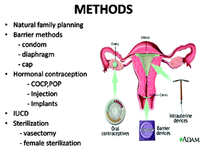 Family Planning: The untold stories - Vanguard News