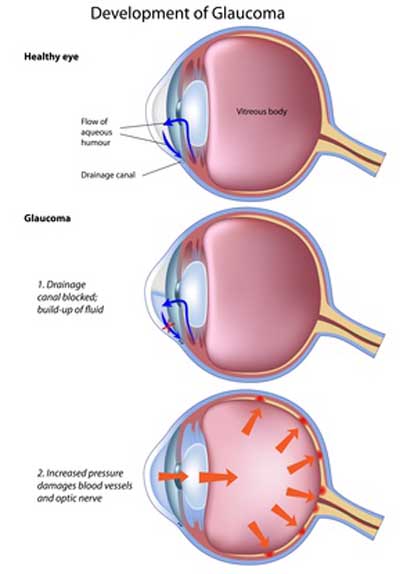 Proper eye care, a must for children–ophthalmologist - Vanguard News