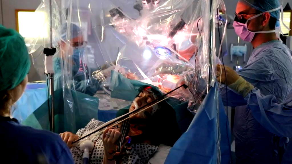 UK musician plays violin while undergoing unusual brain surgery