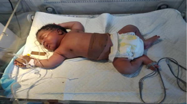 SOS: Baby Shalom seeks N7.5m for corrective heart surgery