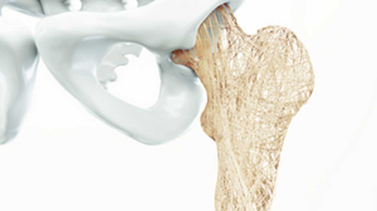 The Secret of Bone Problems and Preventative Ways - Vanguard News