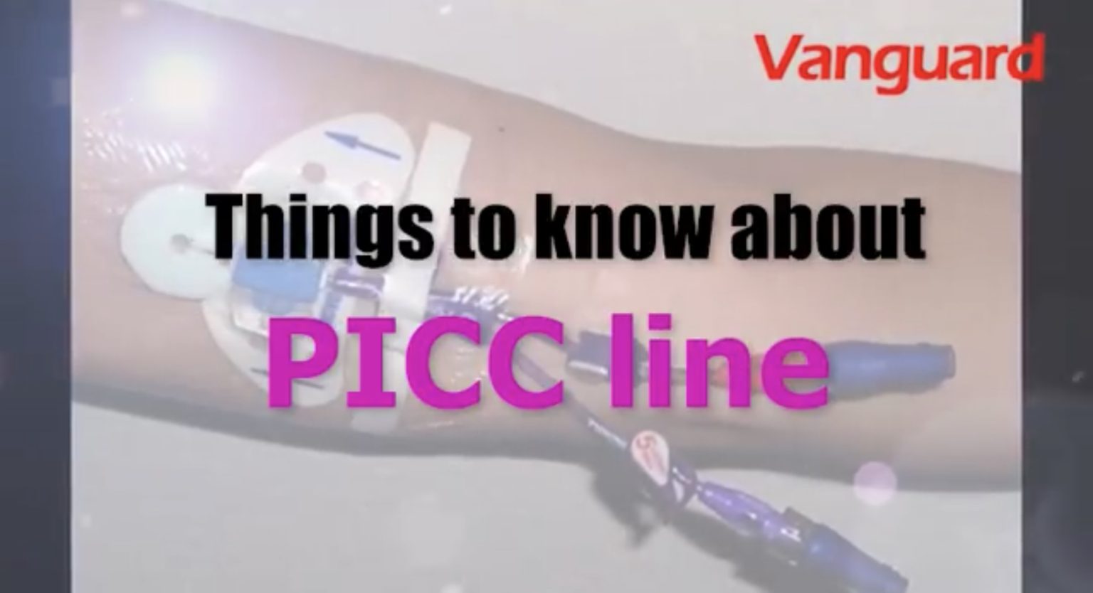 Things to know about PICC line - Vanguard News