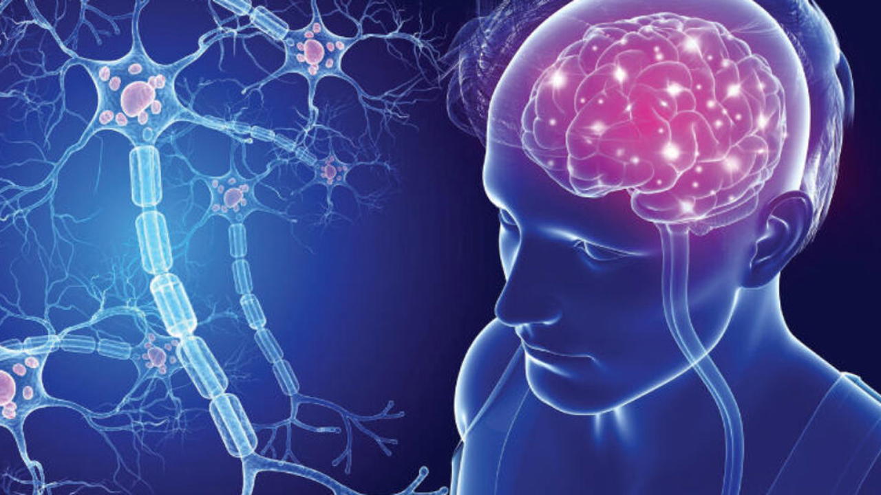 Gene variant linked to multiple sclerosis severity - Vanguard News