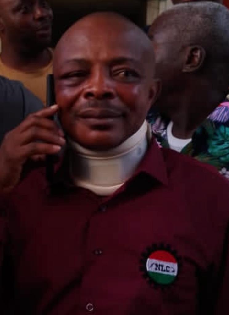 NLC President to undergo ophthalmic investigation, brain scan ...