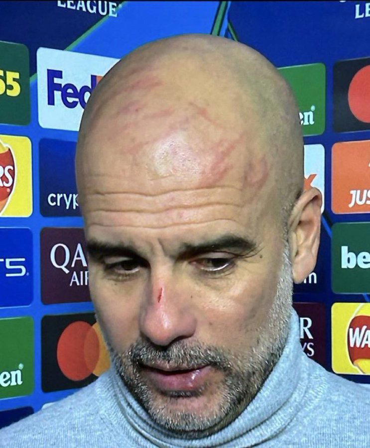 'I was caught off guard,' Guardiola insists no intent to joke with ...