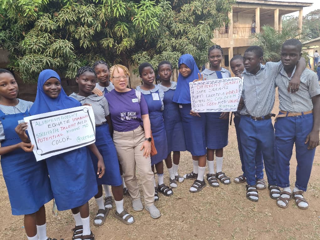 Albinism group demands fair treatment, end to discrimination - Vanguard ...