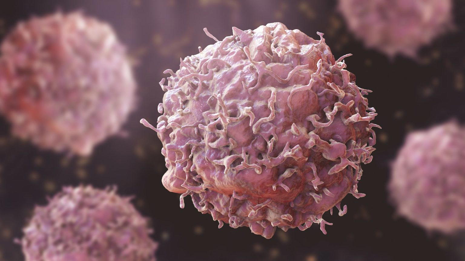 8 ways to reduce your risk of cancer - Vanguard News